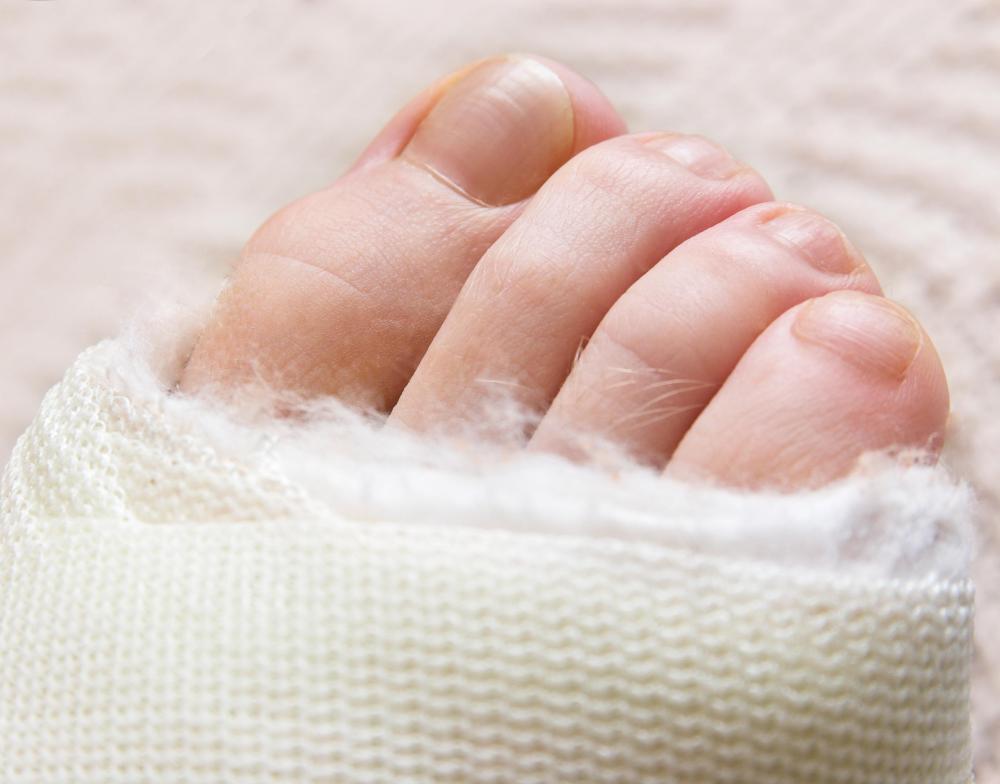 How do I Replace an Axe Handle? (with pictures)